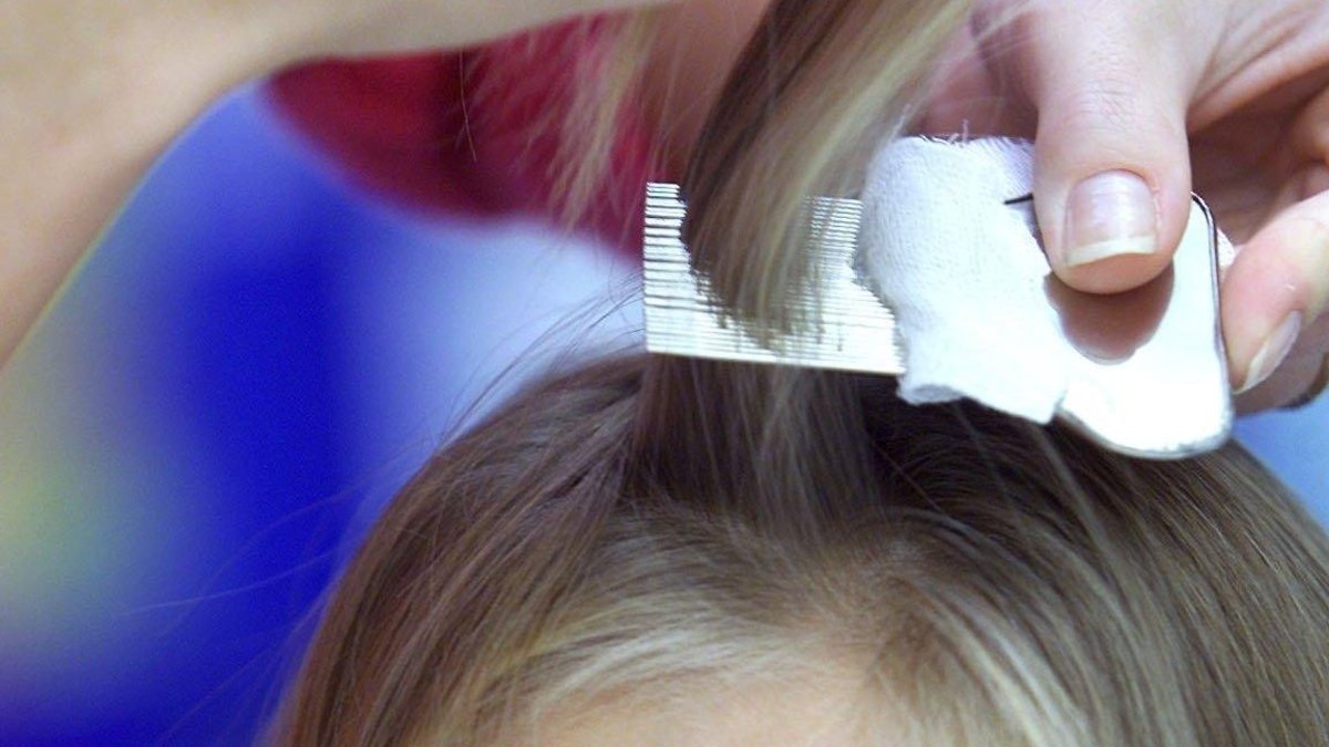 Campagne brengt probleem hoofdluizen in kaart