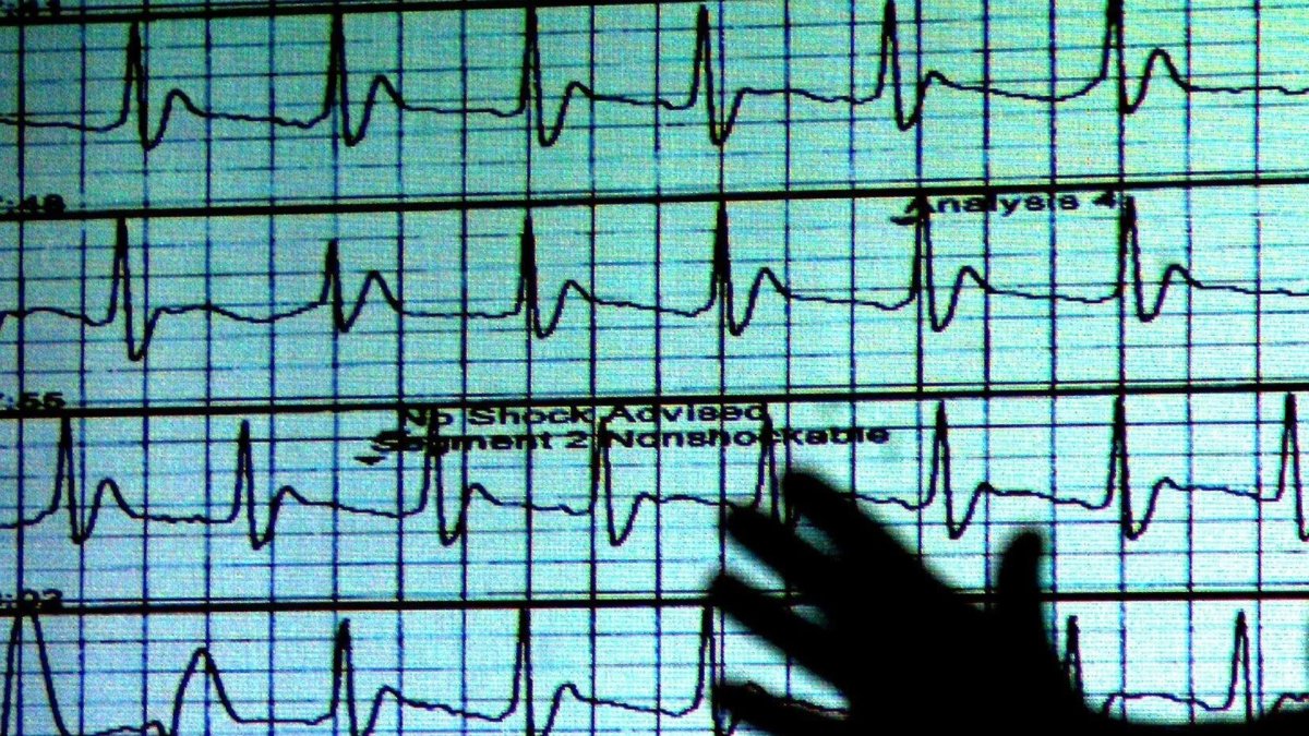 Kans op overleving bij hartstilstand meer dan verdubbeld