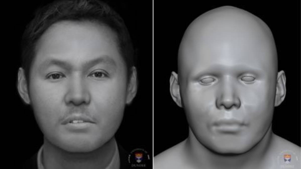 Ruim 10 tips na reconstructie gezicht dode man Utrecht