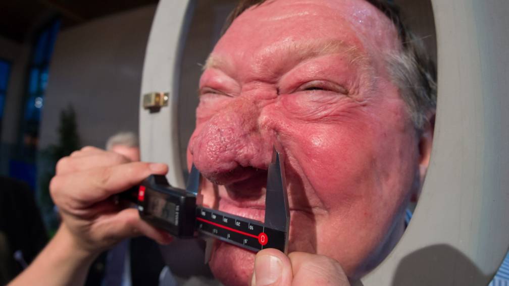 Nederlander heeft opnieuw grootste neus ter wereld | NOS