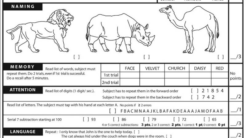 Met deze test bewees Trump dat hij 'messcherp' is