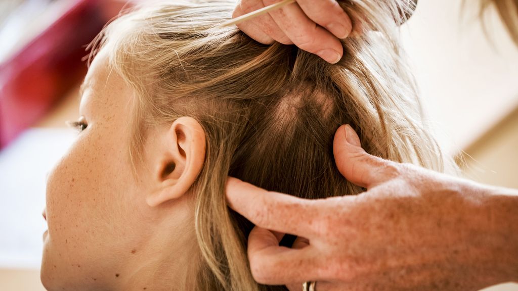 Waarom hebben we luizen en waarom jeuken ze?