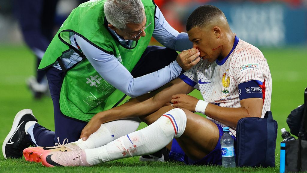 Met een gebroken neus en een masker meteen weer spelen? 'Ligt aan herstel'