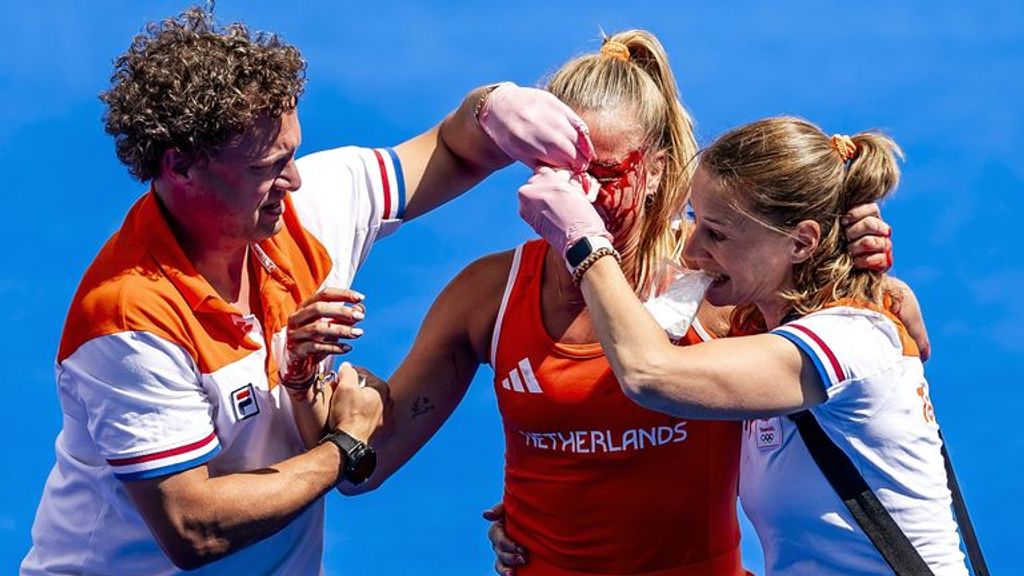 Hockeyster Burg mist finale door gebroken neus, Dicke opgeroepen als ...