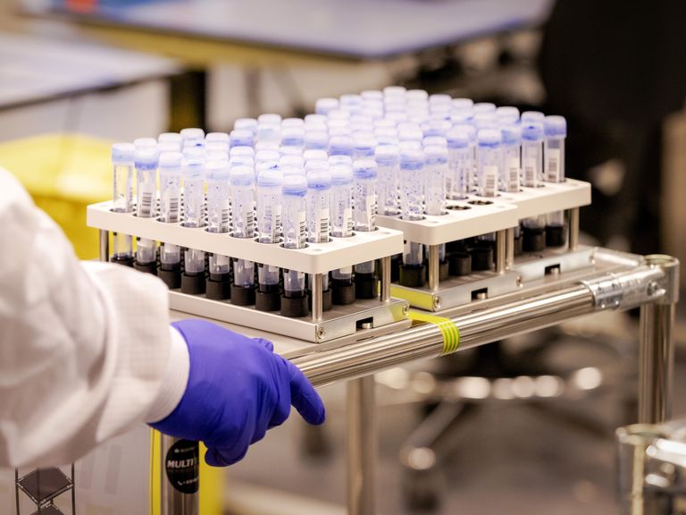 Actieve tuberculose vastgesteld bij PSV-speler, voetballer maakt het goed