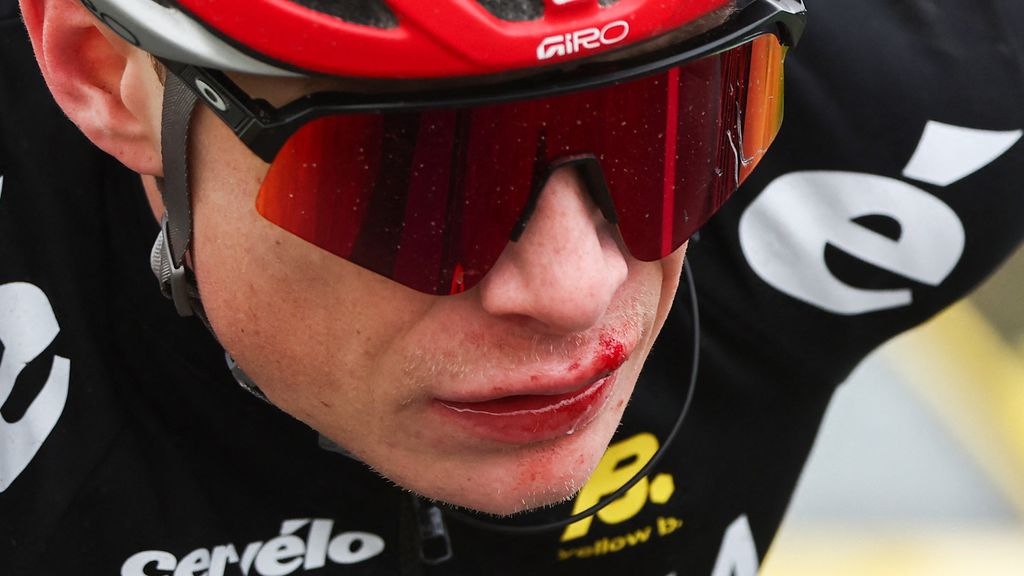 Gekneusde hand Vingegaard, onduidelijk of hij nog opstapt in Parijs-Nice