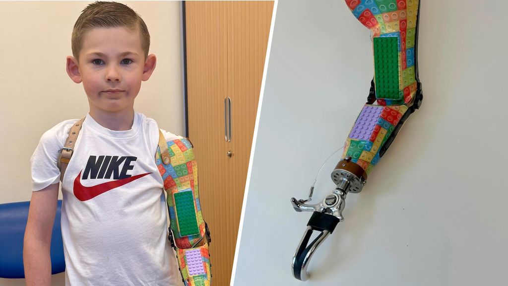 Toby heeft een arm-prothese met Lego