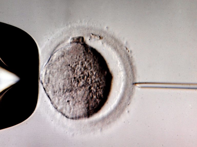 Tweede Kamer stemt in met kweek van menselijke embryo's voor onderzoek